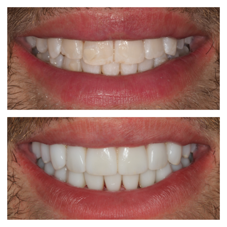 Dentistry Services | Incredible Smiles - Woodville Park | Munno Para ...